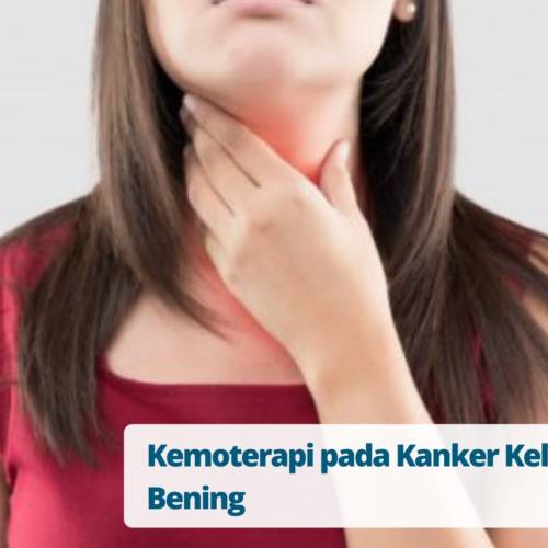 Terapi Kanker Kulit: Pengobatan dan Penanganan - Primaya Hospital