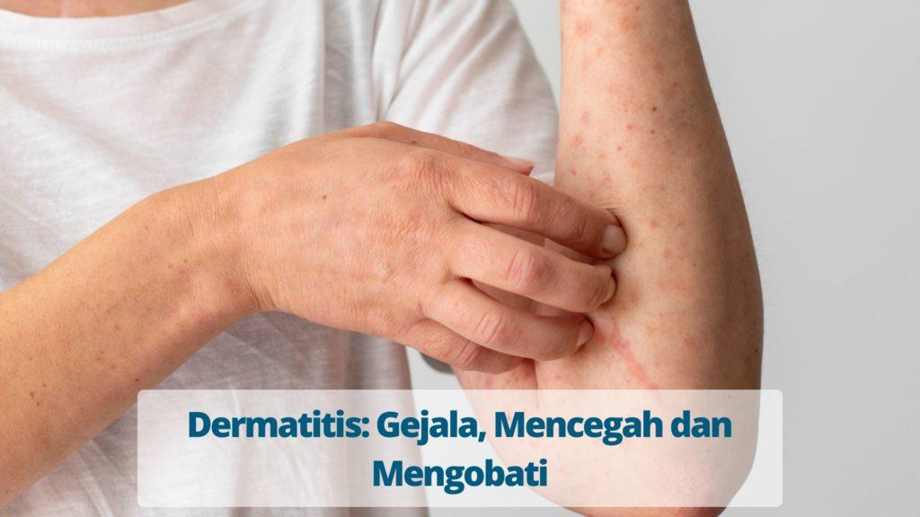 Dermatitis: Gejala, Mencegah dan Mengobati - Primaya Hospital