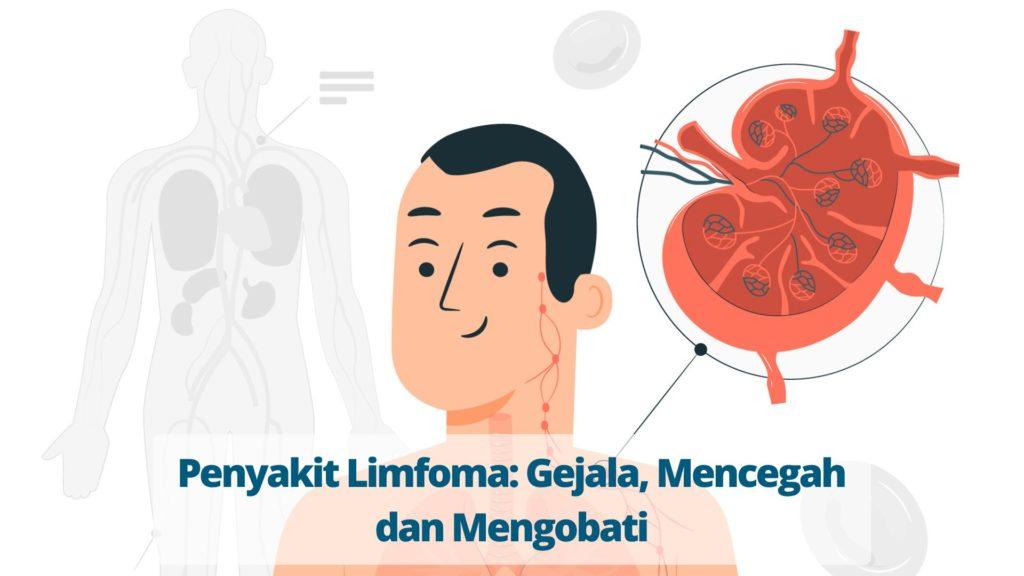 Penyakit Limfoma: Gejala, Mencegah dan Mengobati - Primaya Hospital