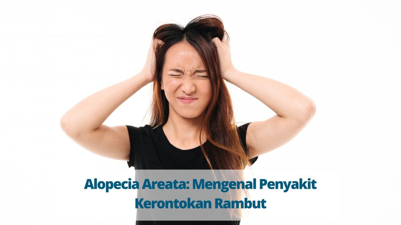 Alopecia Areata: Mengenal Penyakit Kerontokan Rambut