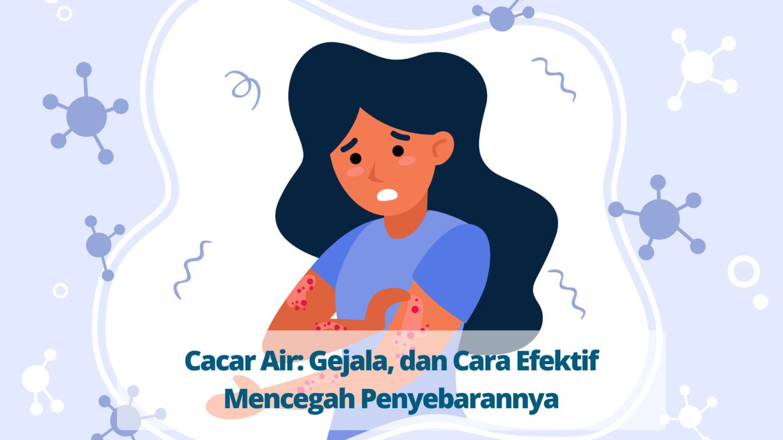 Cacar Air: Gejala, dan Cara Efektif Mencegah Penyebarannya