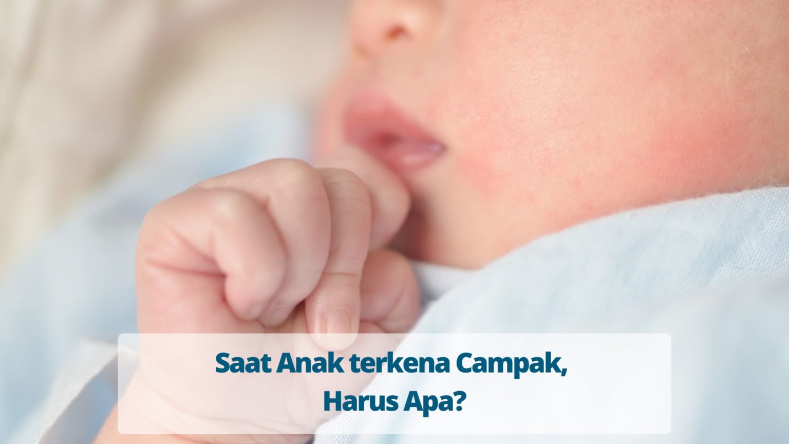 Saat Anak terkena Campak, Harus Apa? - Primaya Hospital