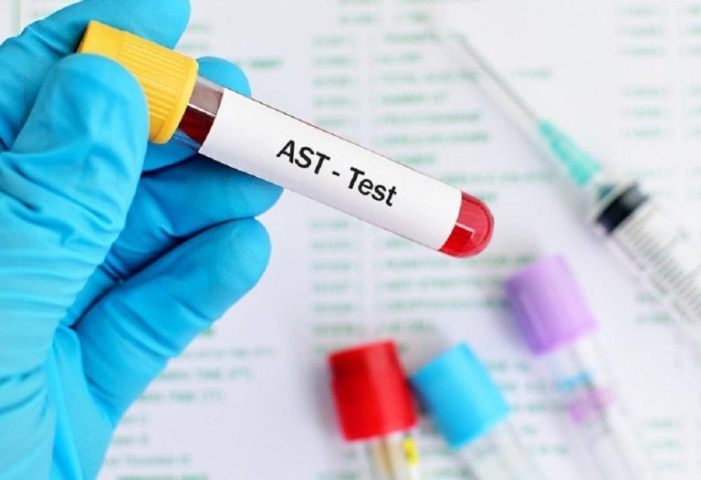 Pemeriksaan AST/SGOT untuk Mengetahui Kondisi Fungsi Hati - Primaya ...
