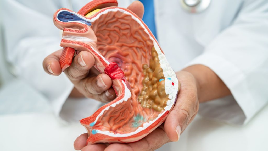 Famotidine: Dosis, Efek Samping, dan Aturan Pakainya - Primaya Hospital