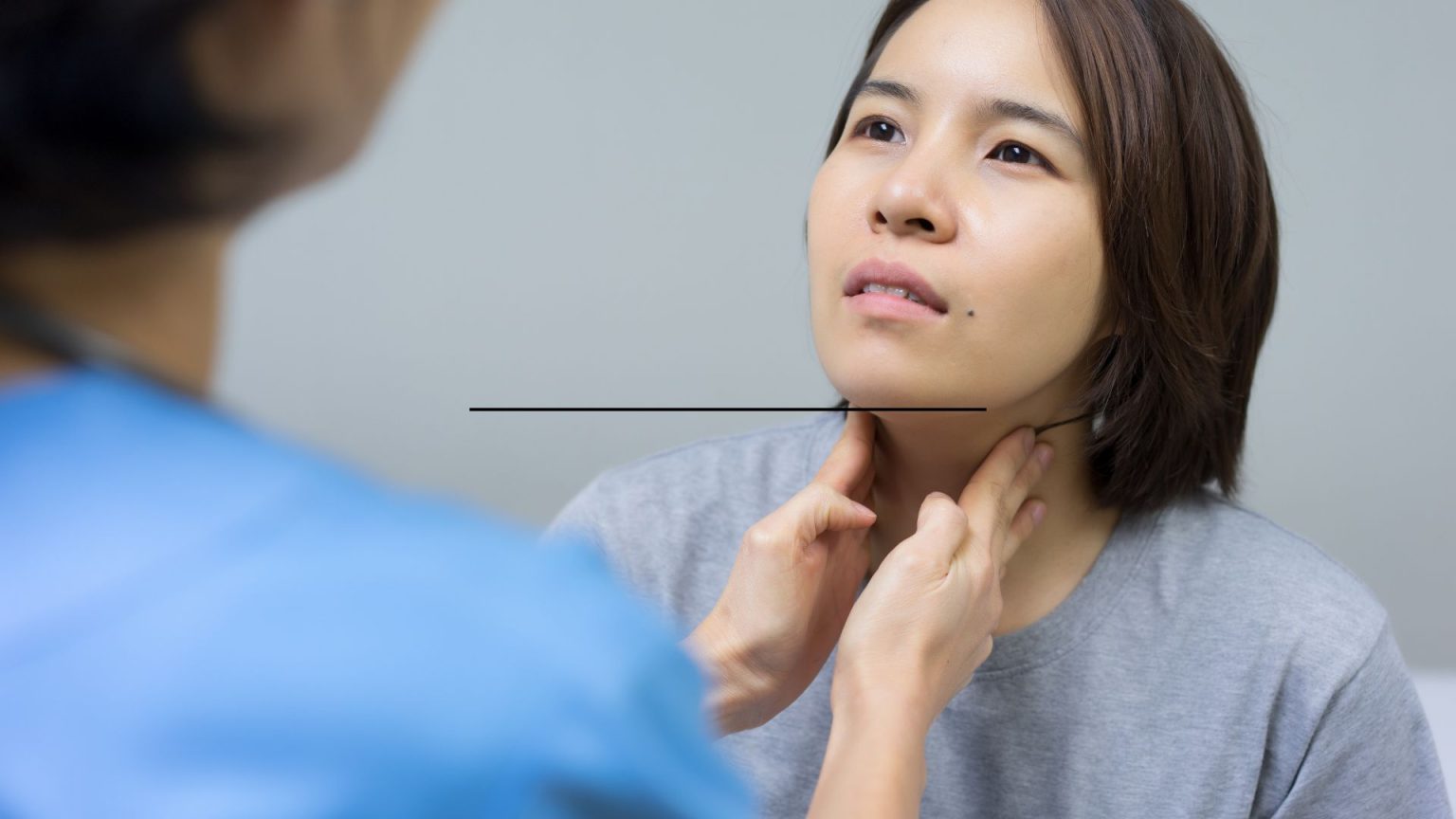 Perawatan Stoma : Jenis, Penyebab, Prosedur dan Perawatannya - Primaya ...